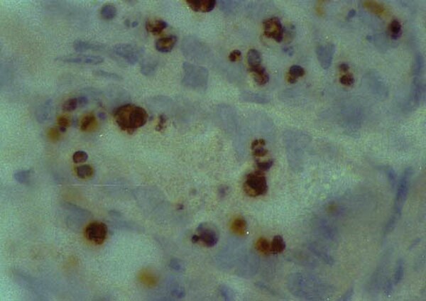 Anti-DNA Antibody, single stranded specific, clone F7-26 | MAB3299